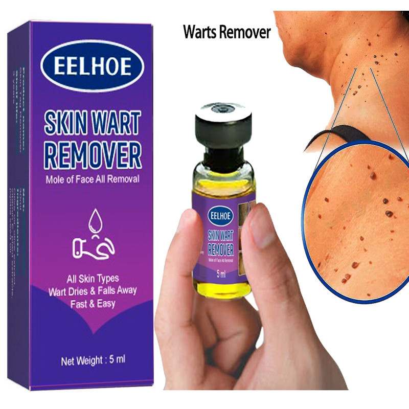 Skin Tag Remover – Ponnokini